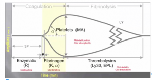 Thromboelastography (TEG®) for Trauma - emDocs