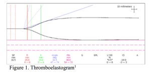 emDOCs.net – Emergency Medicine EducationThe Thromboelastogram (TEG ...