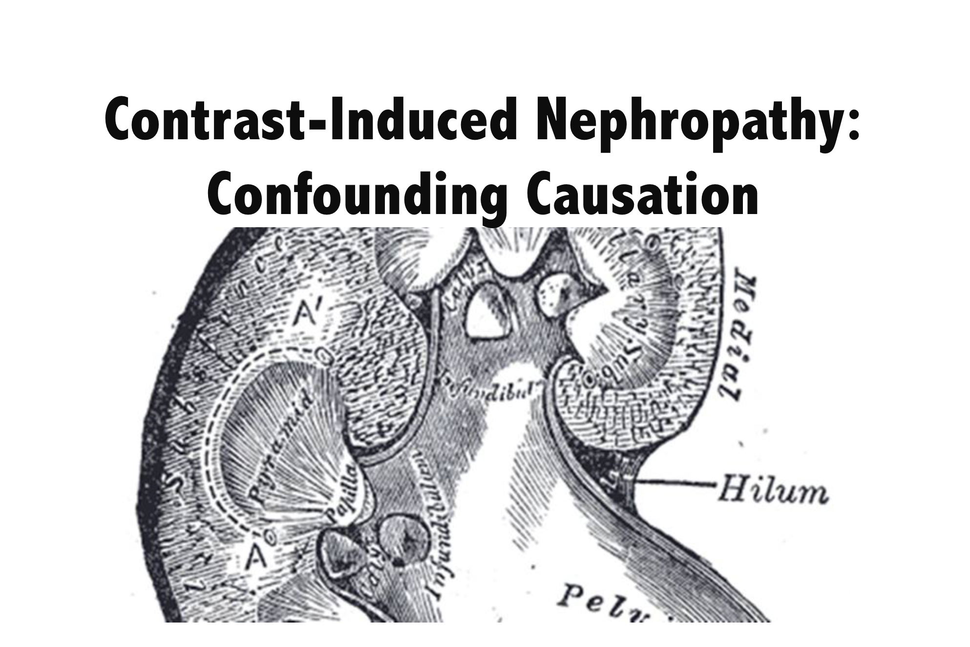 Contrast-Induced Nephropathy: Confounding Causation - emdocs