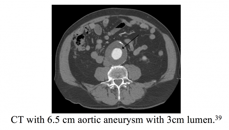emDOCs.net – Emergency Medicine EducationBiliary Colic Mimics: What you ... emDOCs.net – Emergency Medicine EducationBiliary Colic Mimics: What you ...