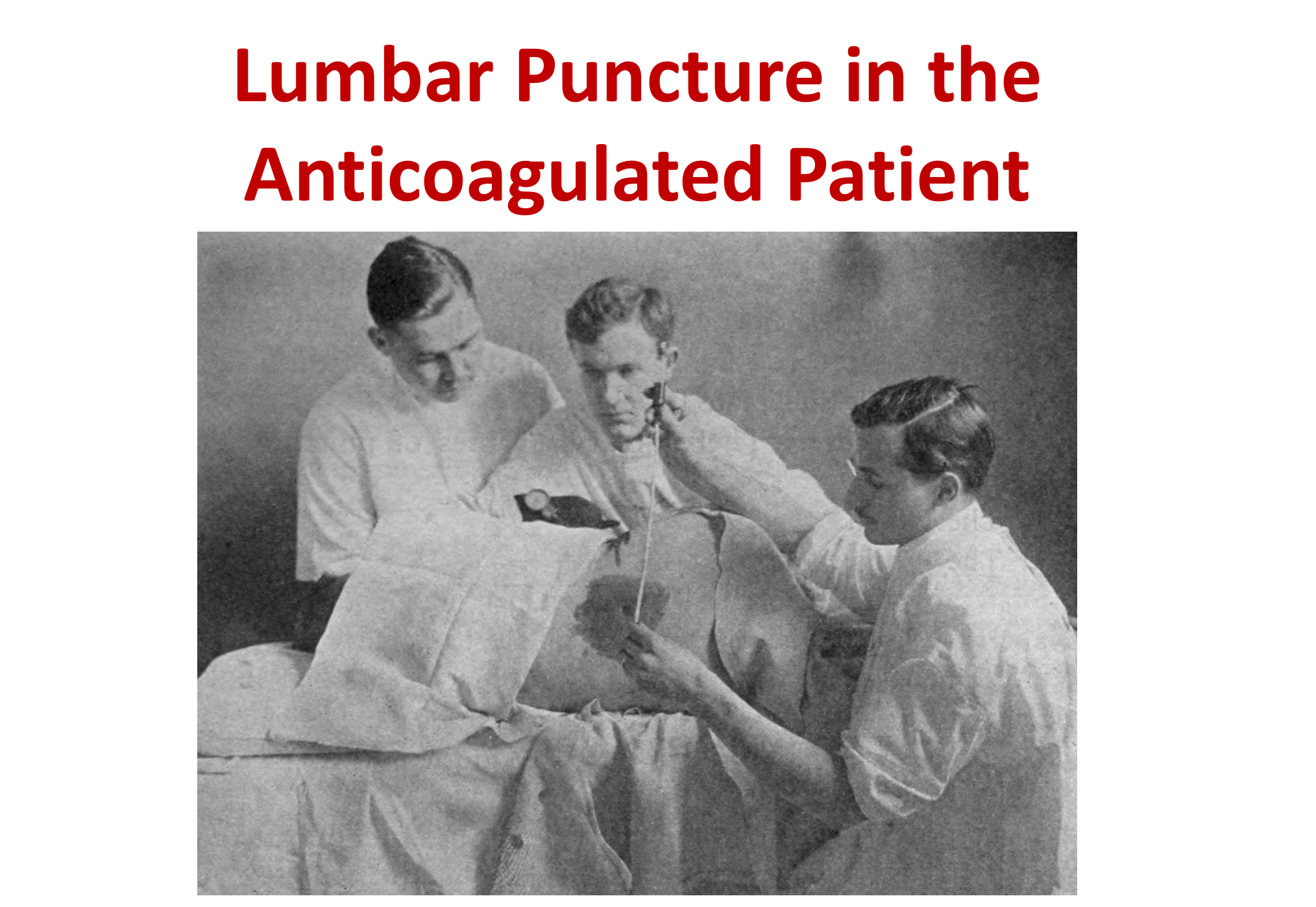 Post lumbar puncture side effects - sherysn