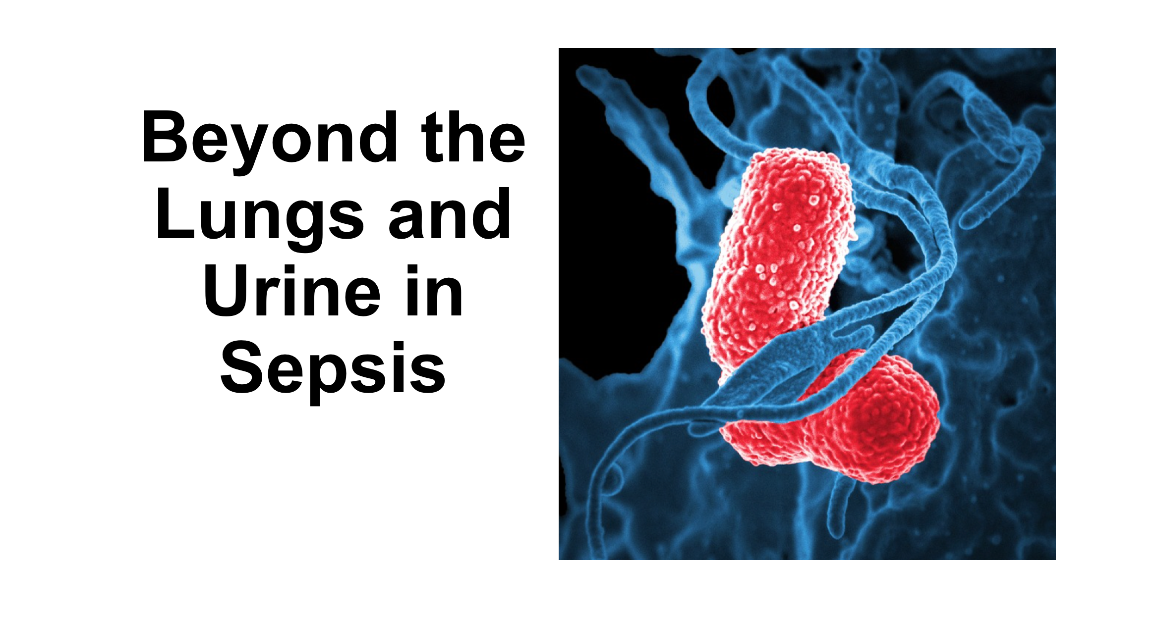 So you think it is sepsis: considerations beyond lung and urine in the ...