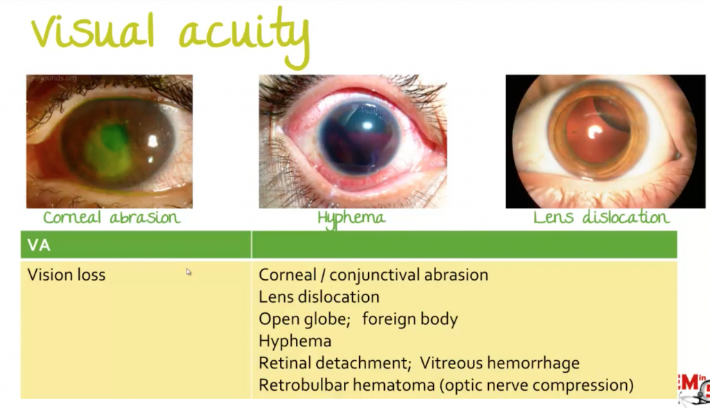 emDOCs.net – Emergency Medicine EducationEM in 5: Ocular Trauma ...