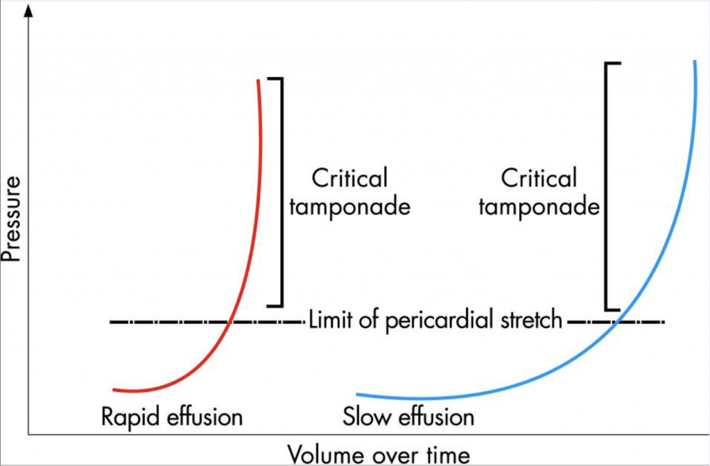 emDOCs.net – Emergency Medicine EducationImage 3 - Pressure Volume ...