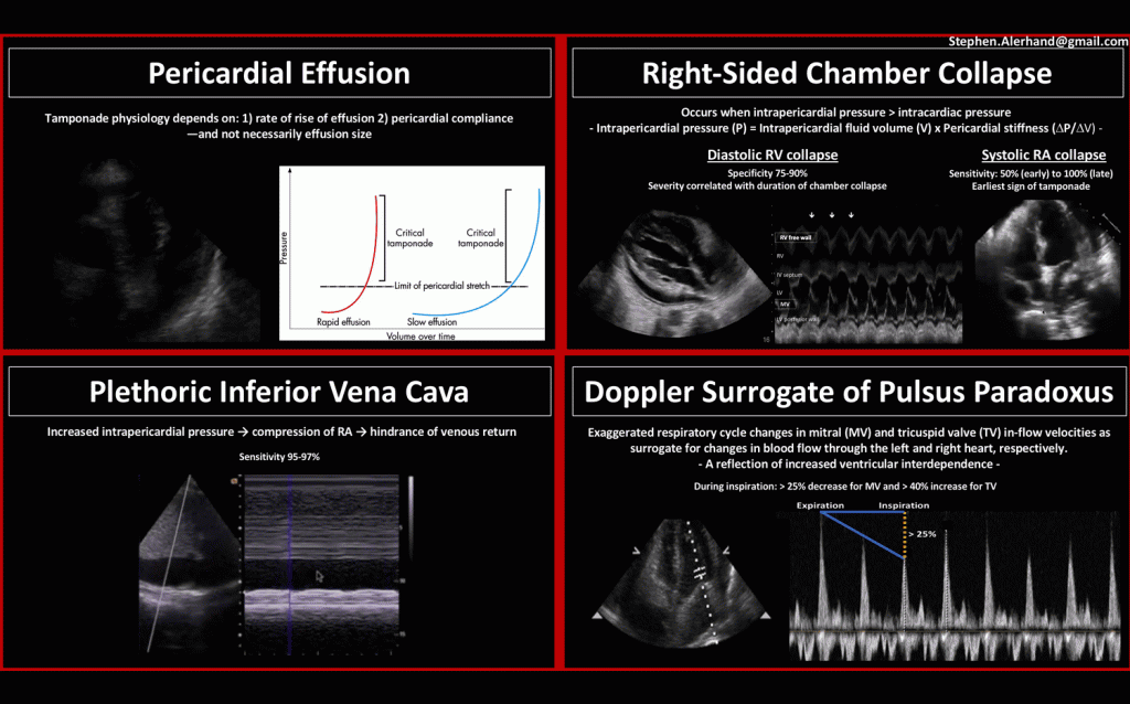 emDOCs.net – Emergency Medicine EducationUS Probe: When Does an ...