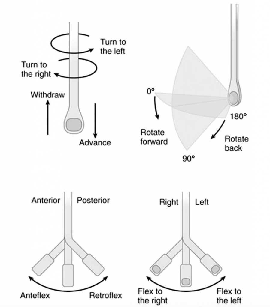 emDOCs.net – Emergency Medicine EducationTEE probe manipulations ...