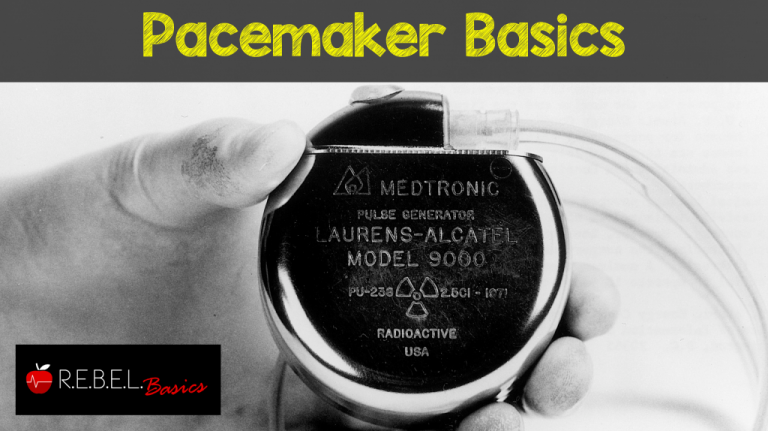 emDOCs.net – Emergency Medicine EducationR.E.B.E.L. EM – Pacemaker ...