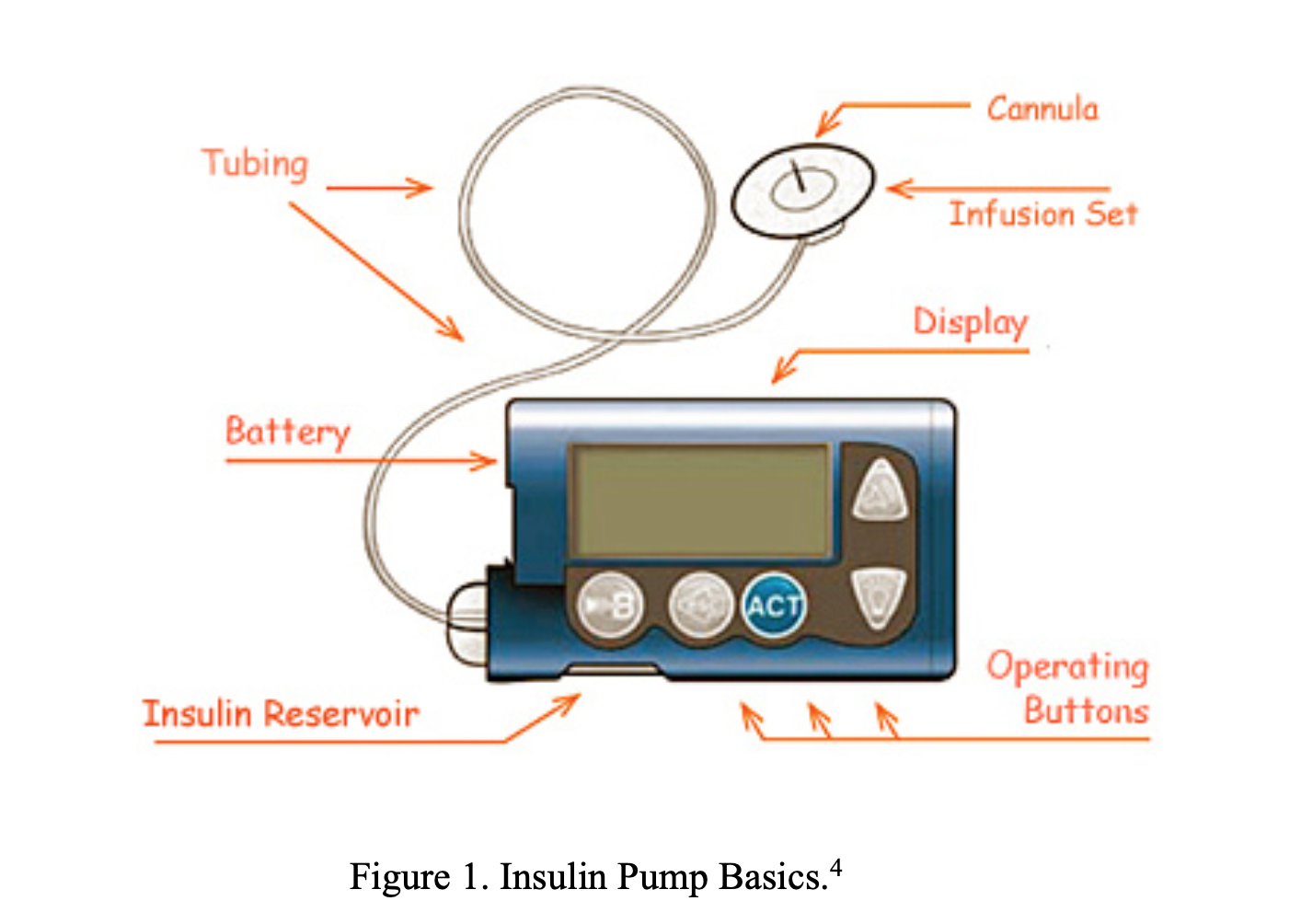 emDOCs.net – Emergency Medicine EducationInsulin Pumps: Complications ... emDOCs.net – Emergency Medicine EducationInsulin Pumps: Complications ...