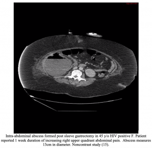 emDOCs.net – Emergency Medicine EducationIntra-abdominal Abscess ...