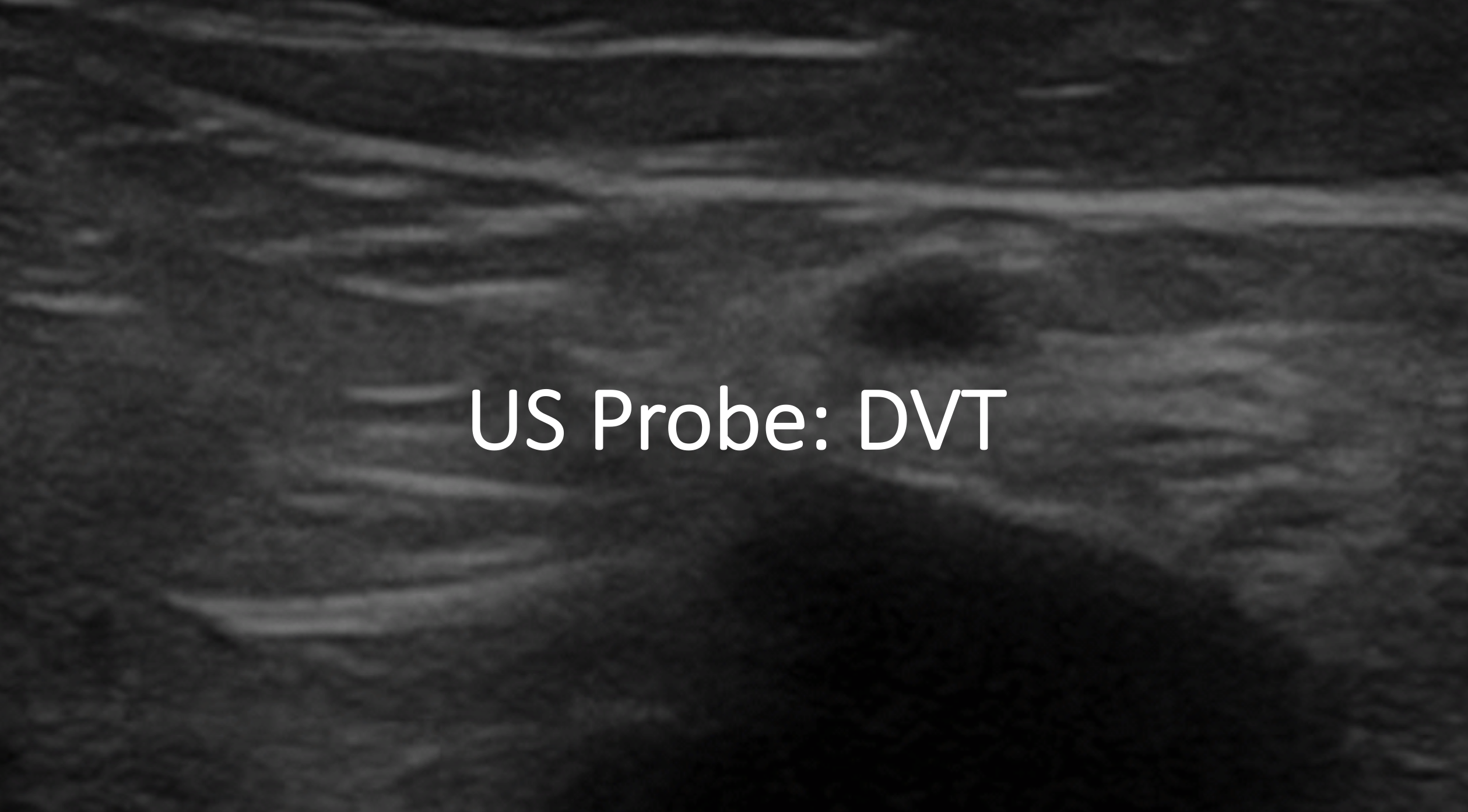 emDOCs.net – Emergency Medicine Educationultrasound Archives - Page 2 ...