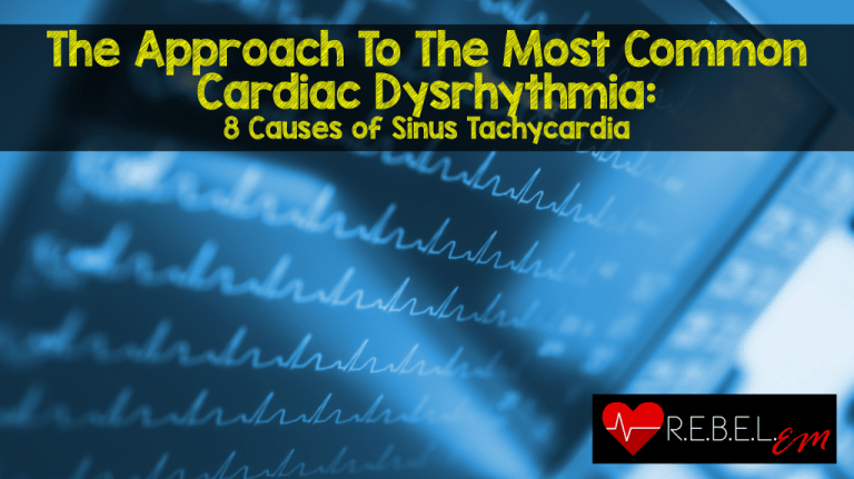 tachycardia Archives - emDocs