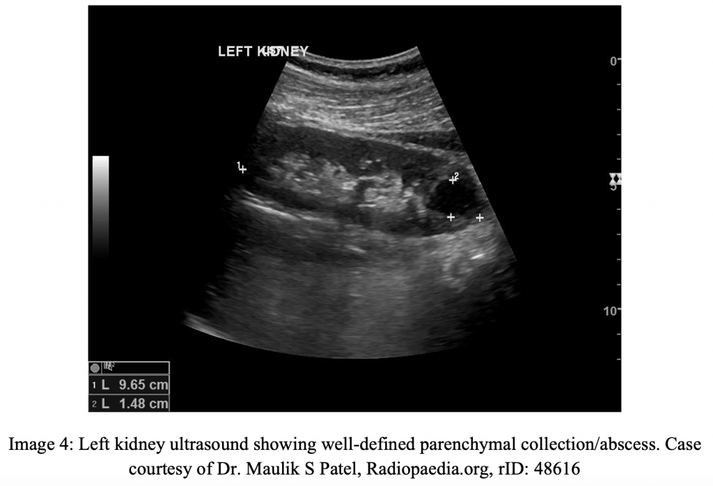 emDOCs.net – Emergency Medicine EducationEmergency Department ...