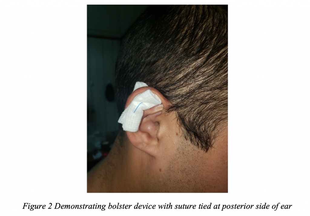 emDOCs.net – Emergency Medicine EducationPreventing Scarface: Pearls ...