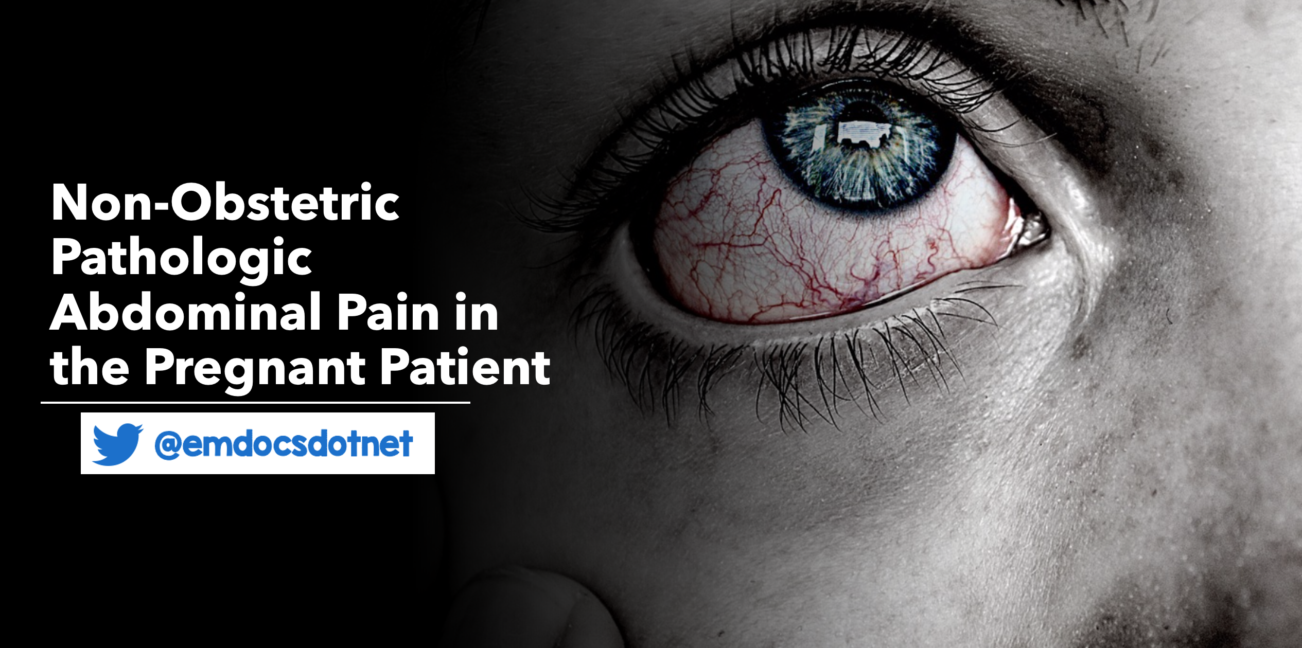 emDOCs.net – Emergency Medicine Educationpractice updates Archives ...