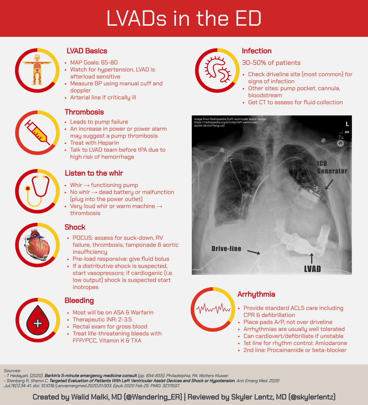 emDOCs.net – Emergency Medicine EducationVisual Wednesdays: LVADs in ...