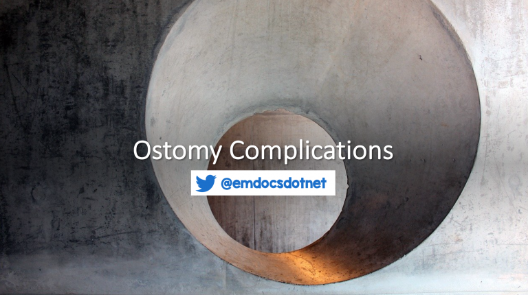 Ostomy complications: ED presentations, complications, and management ...