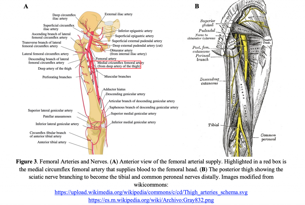 emDOCs.net – Emergency Medicine EducationAn Overview of Femur Fractures ...