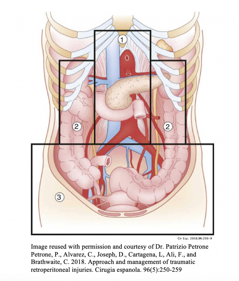 Retroperitoneal Trauma: ED Evaluation and Management - emDocs