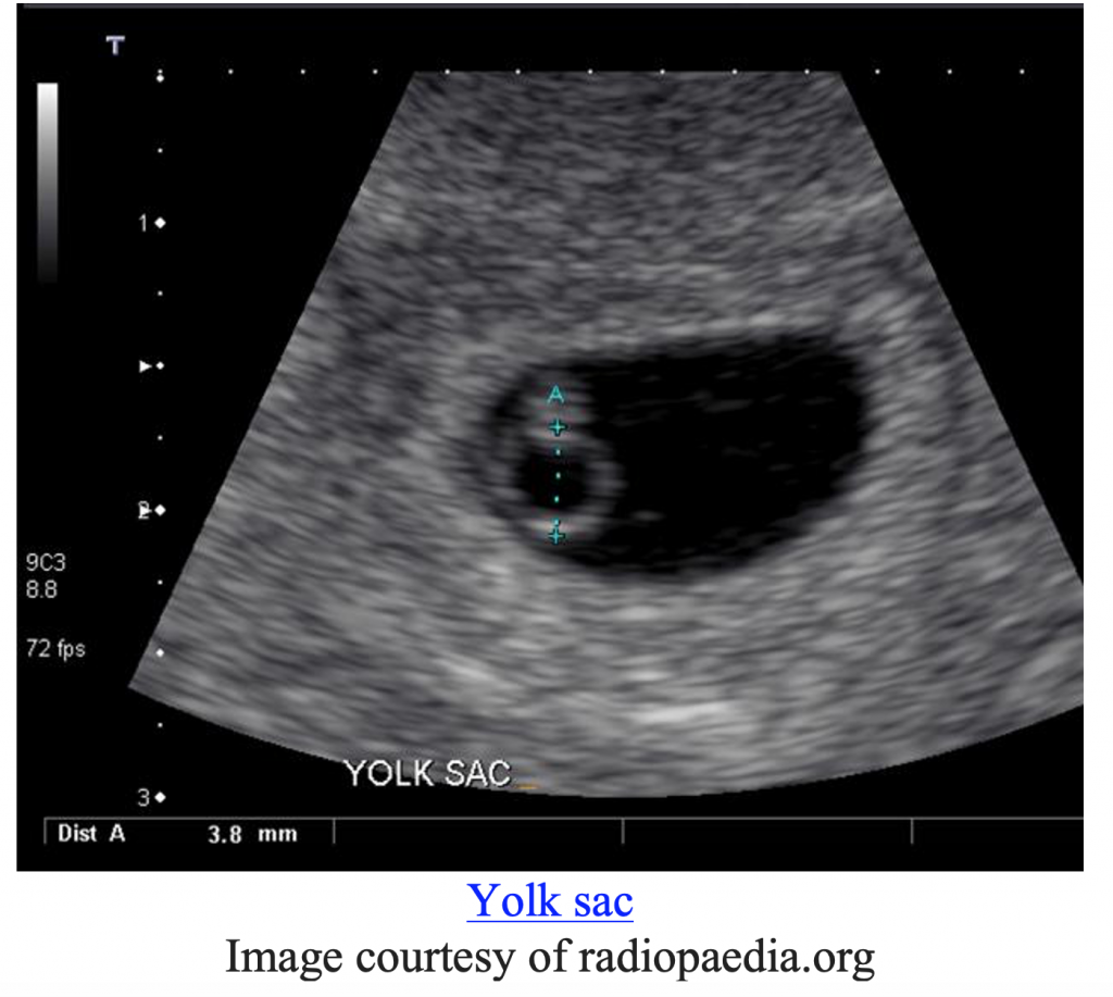 Pelvic Ultrasound Indications Limitations Pearls And Pitfalls Emdocs