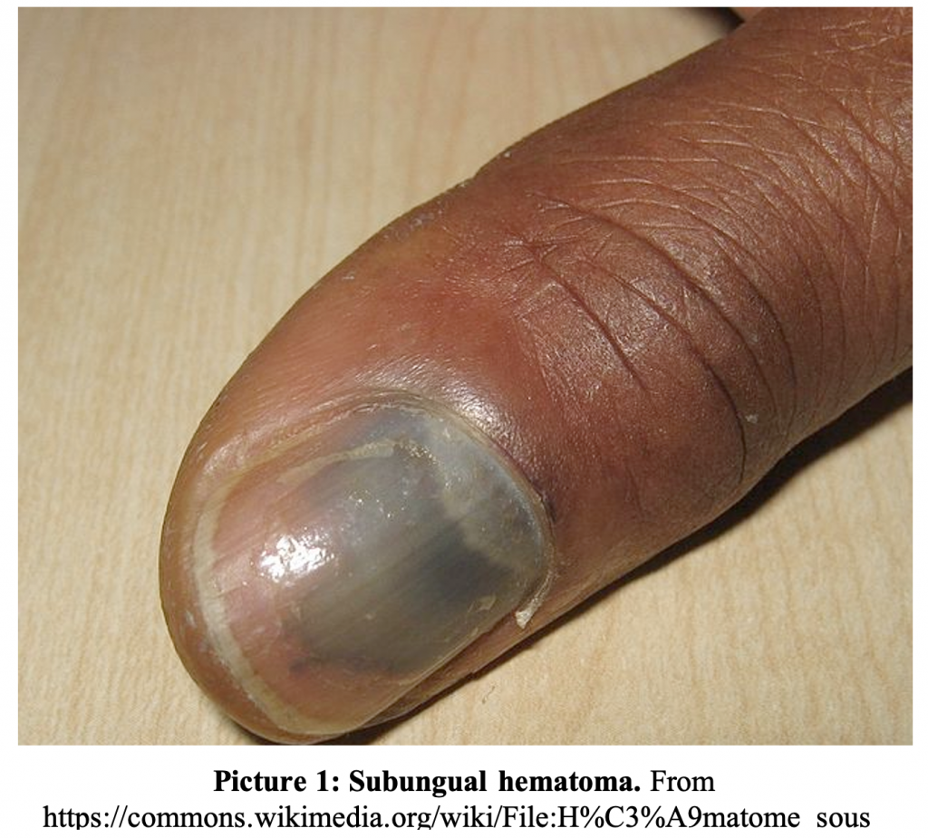 Evidence-based Approach to Nailbed Injuries: ED Presentations ...