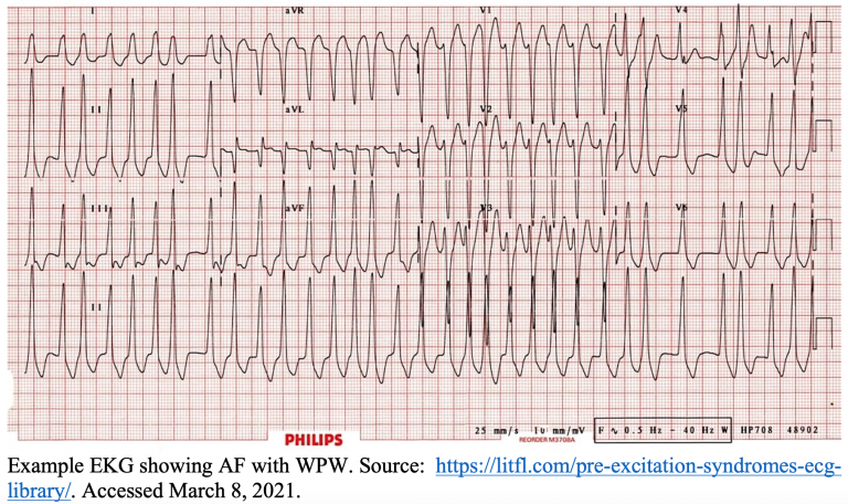 Electrical cardioversion in the ED: who crashes and how to improve - emDocs