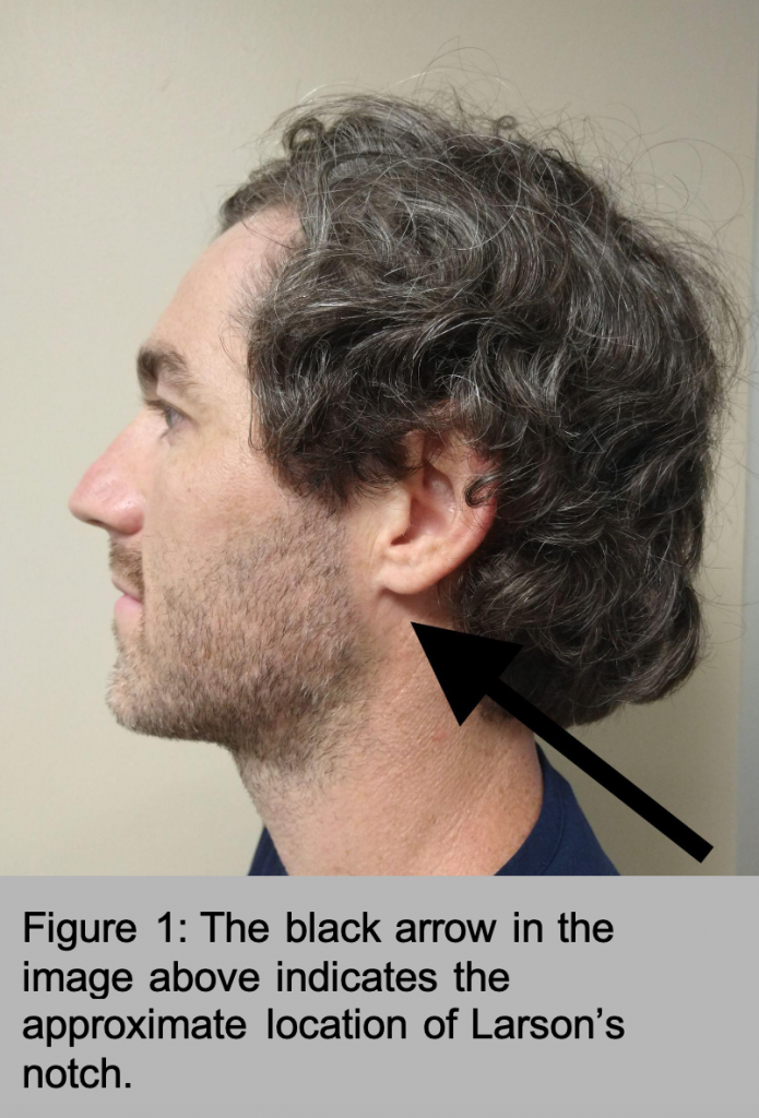 EM@3AM: Laryngospasm - emDocs