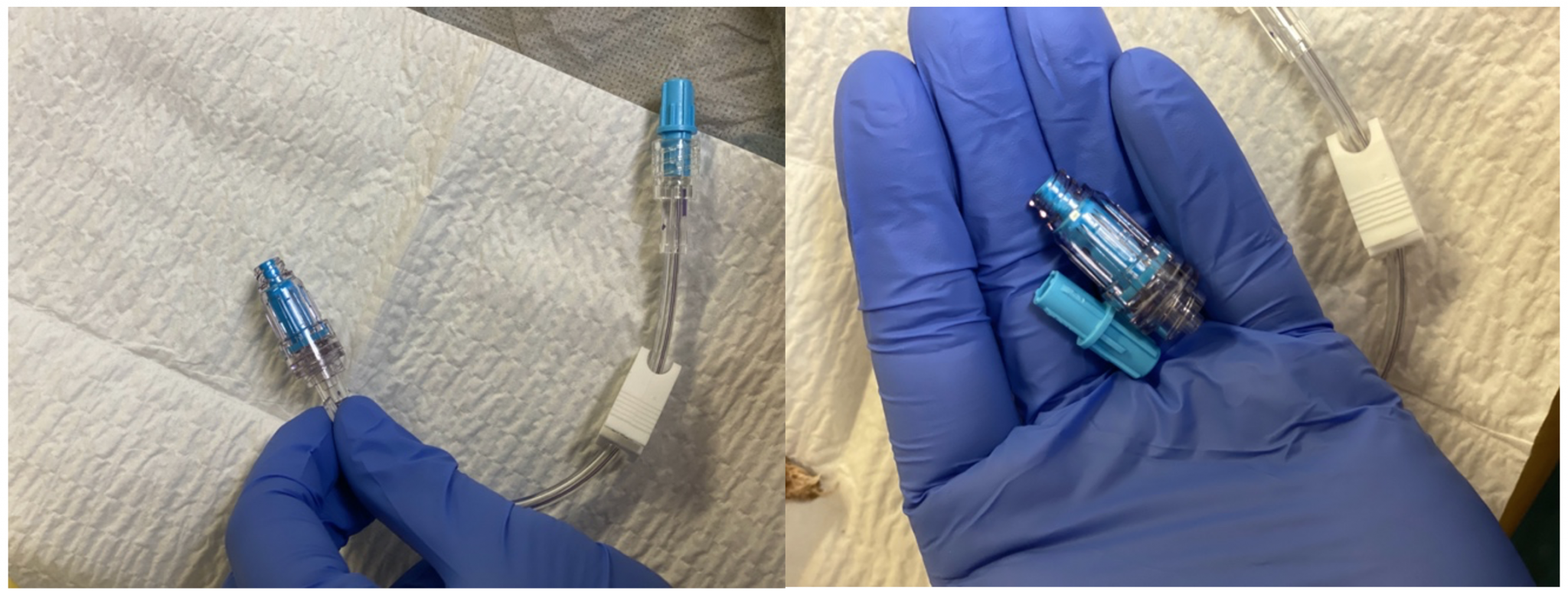 An effective technique for aspiration in ischemic priapism: The ...