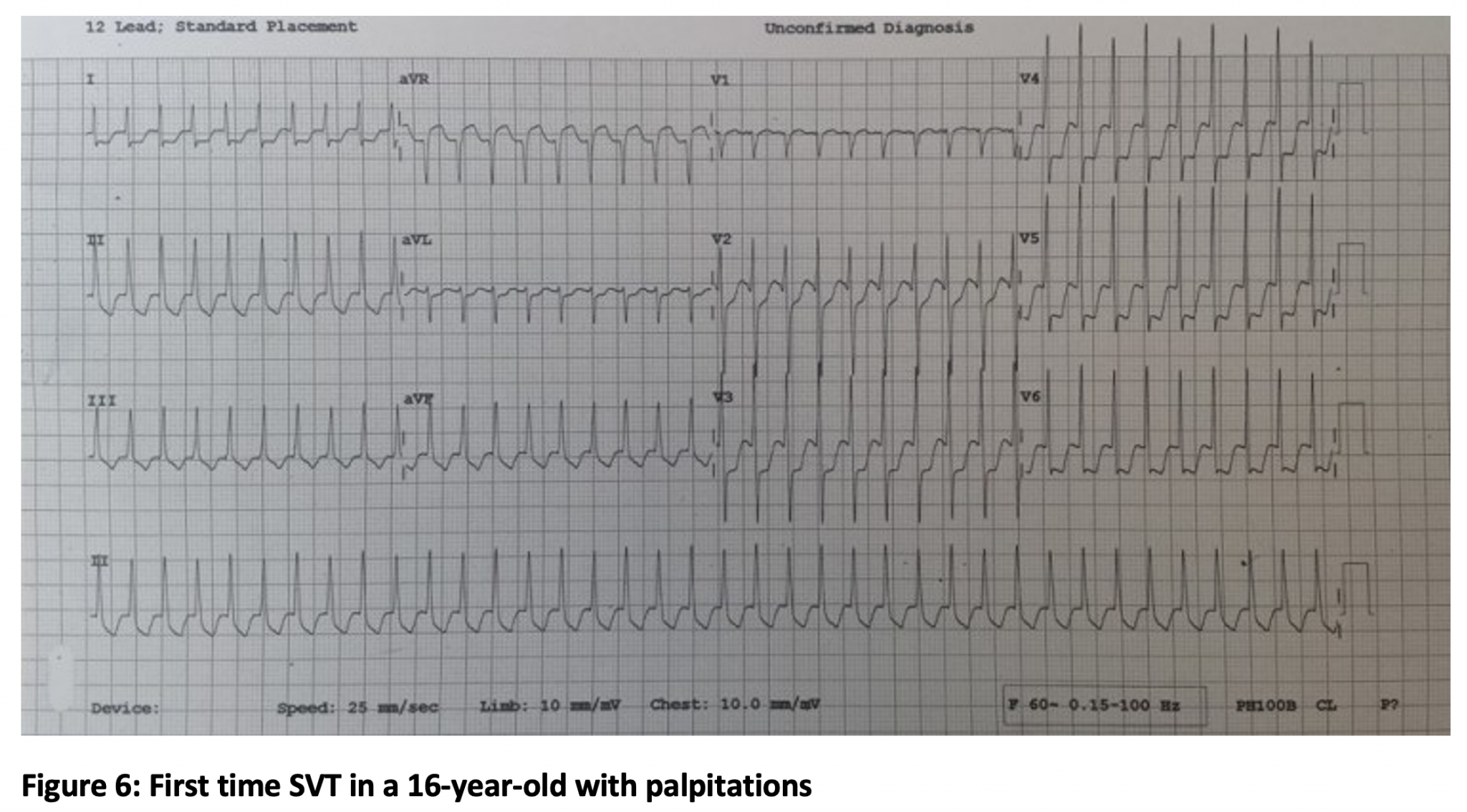 Pediatric Small Talk - The Rhythm Is Gonna Get Ya’: Age Based Approach ...