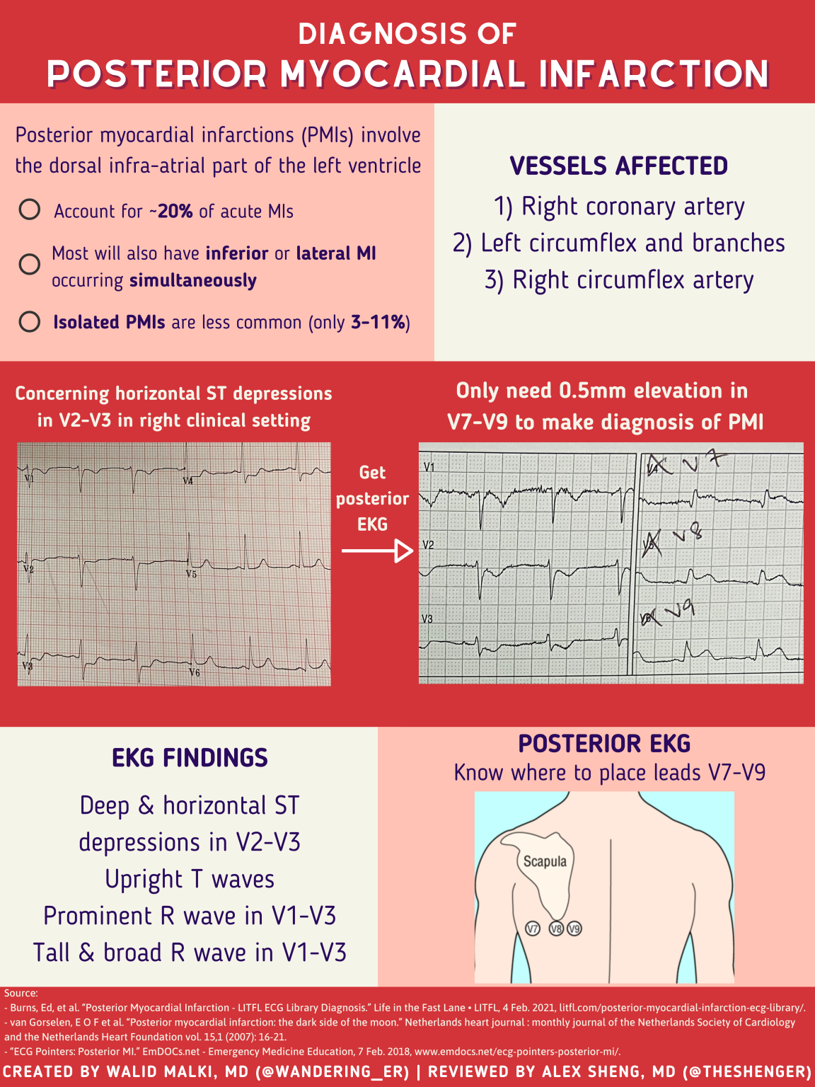emDOCs.net – Emergency Medicine EducationVisual Wednesdays: Posterior ...