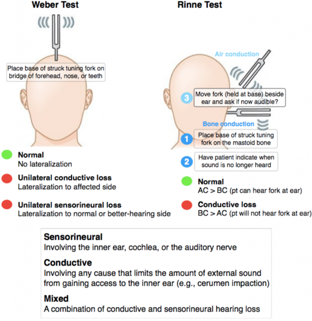 EM@3AM: Cerumen Impaction - emDocs