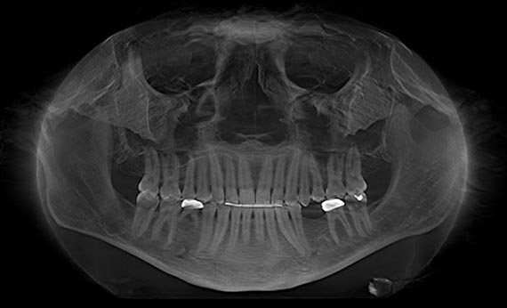 Maxillofacial Trauma - emDocs