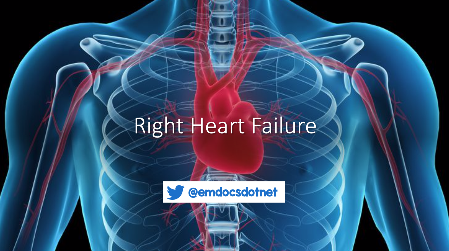 Right Heart Failure in the ED: Approach to Diagnosis and Management ...