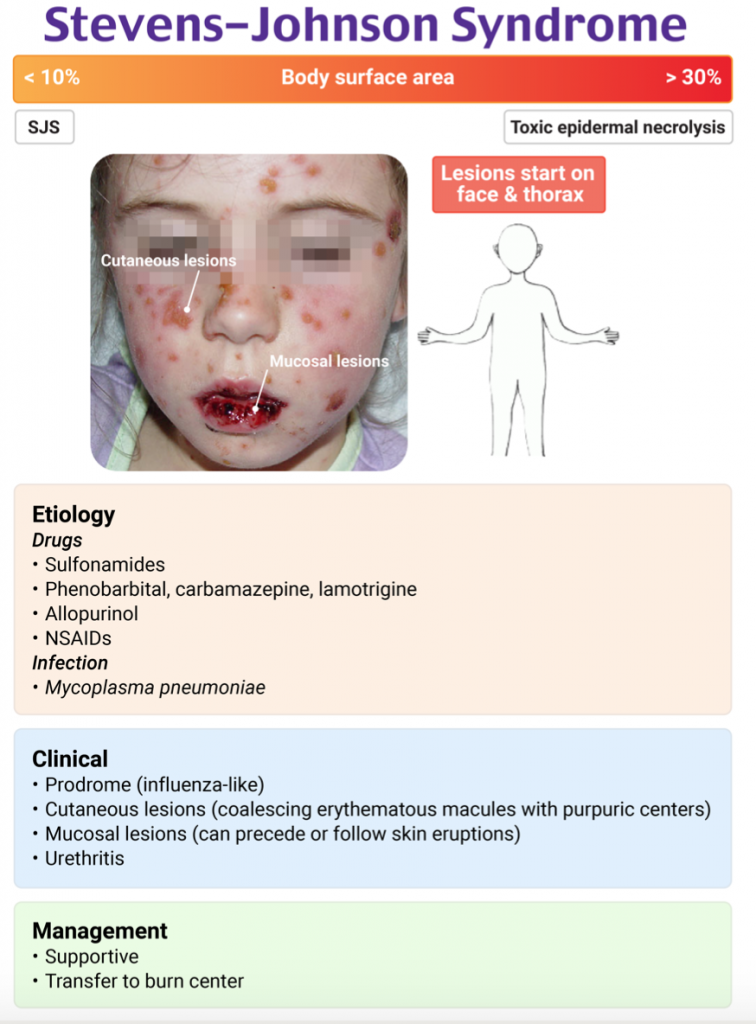 EM@3AM: Stevens-Johnson Syndrome and Toxic Epidermal Necrolysis - emDocs