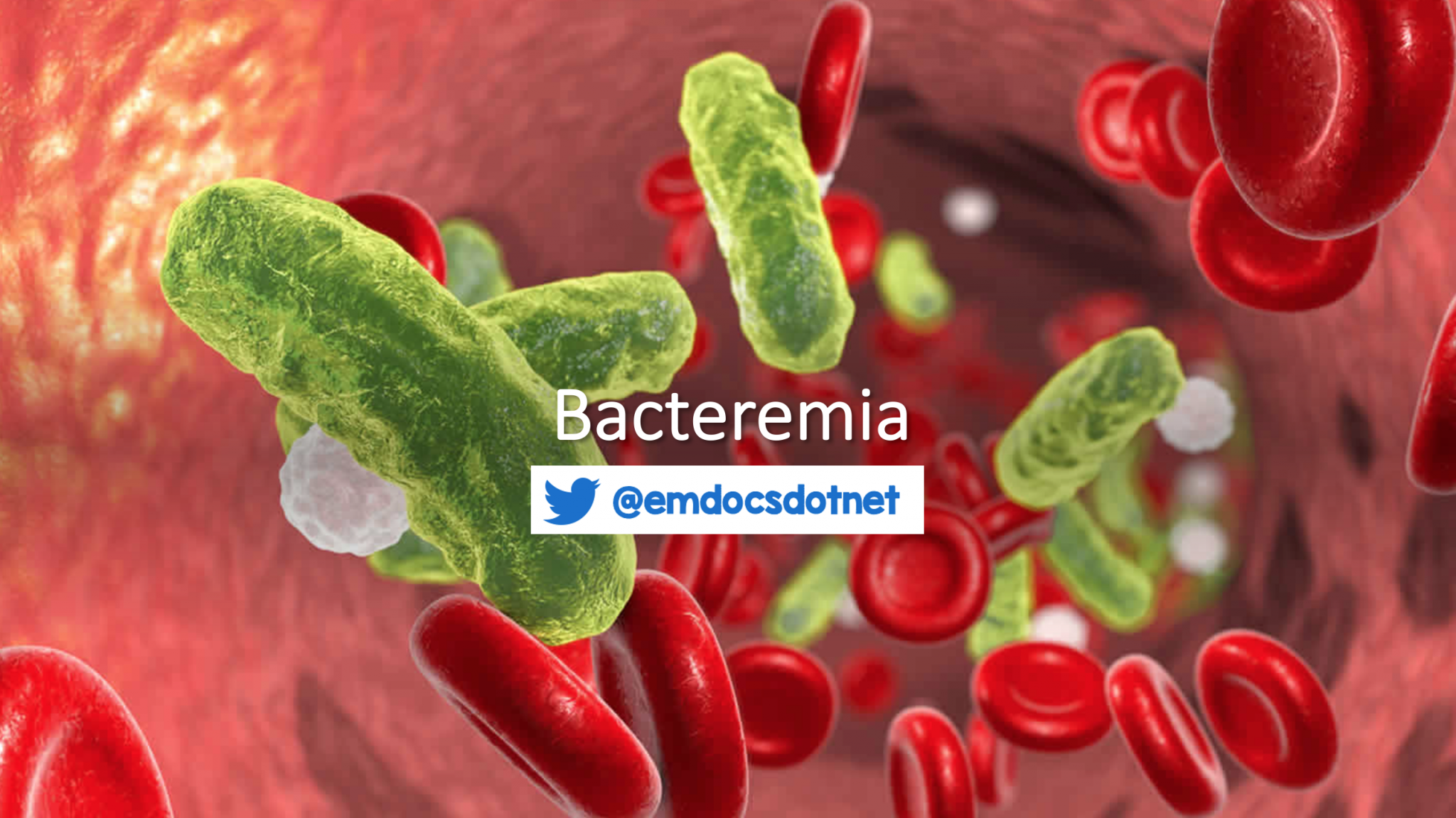 Bacteremia: ED Presentations, Evaluation, and Management - emDocs