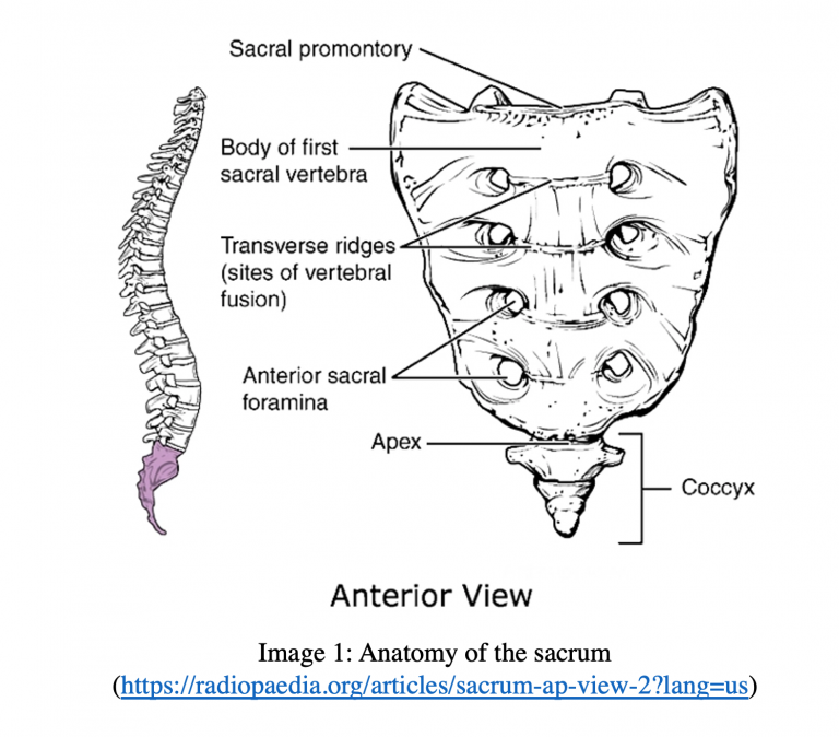 EM@3AM: Sacral fractures - emDocs