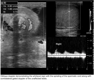 EM@3AM: Testicular Torsion - emDocs