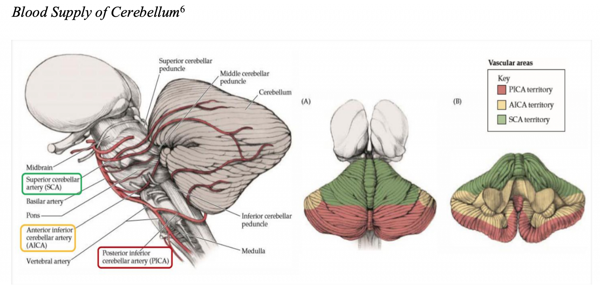 EM@3AM: Cerebellar Stroke - emDocs