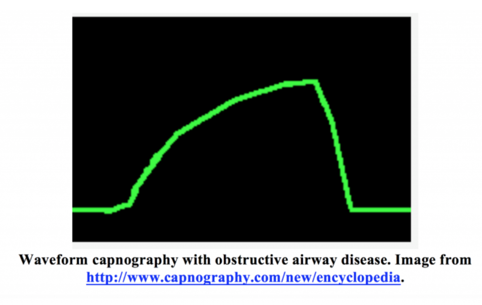 emDOCs Podcast - Episode 84: Capnography - emDocs