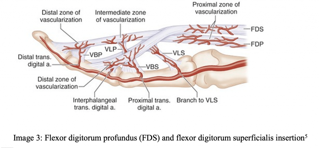 EM@3AM: Flexor Tendon Laceration - emDocs