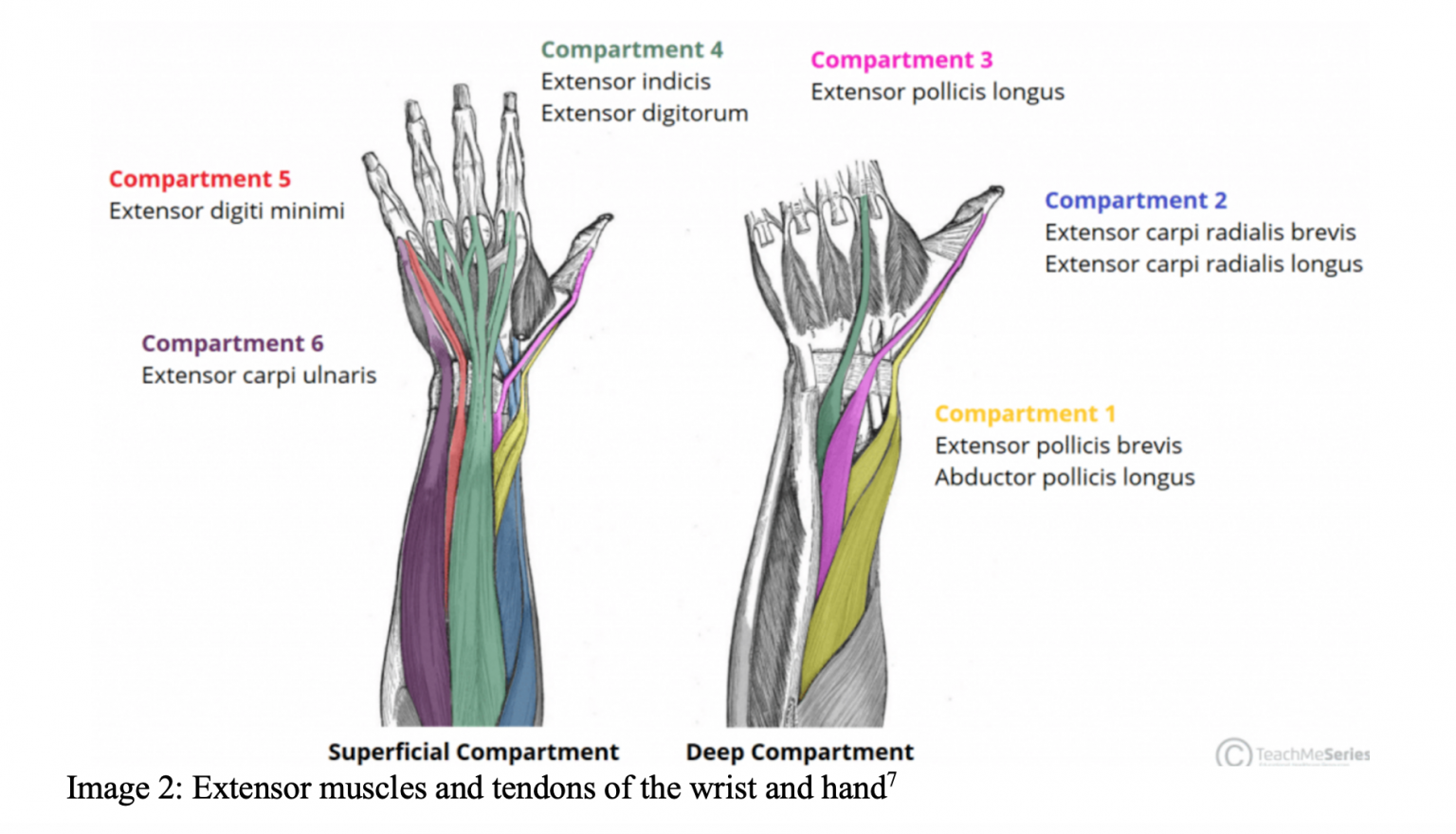 EM@3AM: Extensor Tendon Laceration - emDocs