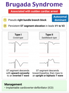 EM@3AM: Brugada Syndrome - emDocs