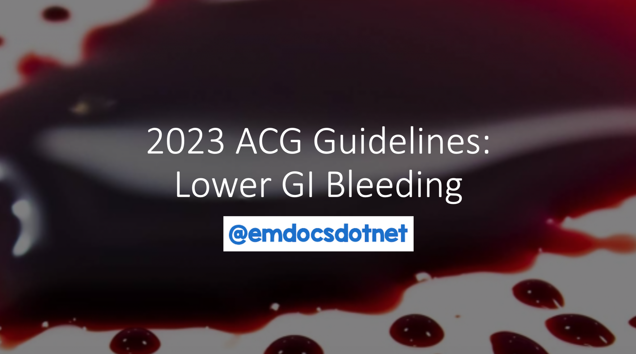 Guideline Update: Acute Lower GI Bleeding - emDocs