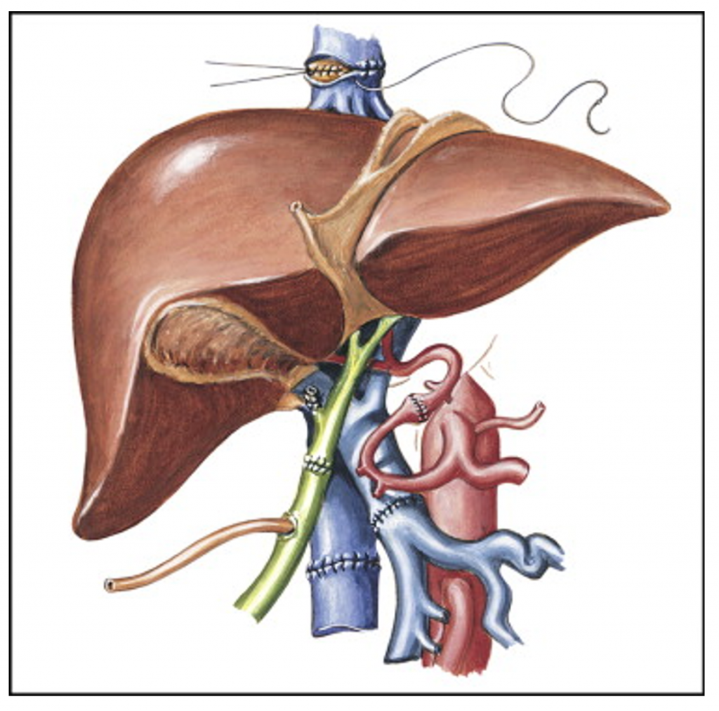 EM@3AM: Liver Transplant Complications - emDocs