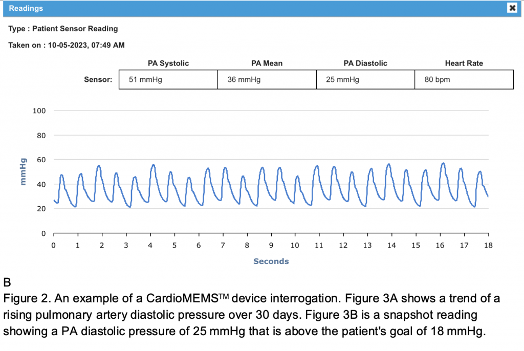 What the Emergency Clinician Must Know about Remote Monitors in Heart Failure - emDocs
