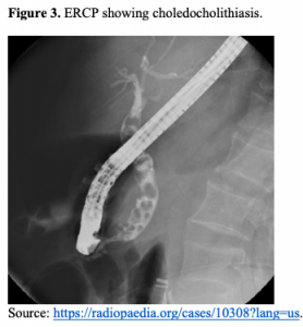 Emergency Department Evaluation of Cholestatic Labs - emDocs
