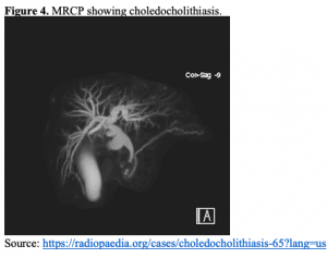 Emergency Department Evaluation of Cholestatic Labs - emDocs