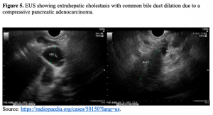 Emergency Department Evaluation of Cholestatic Labs - emDocs