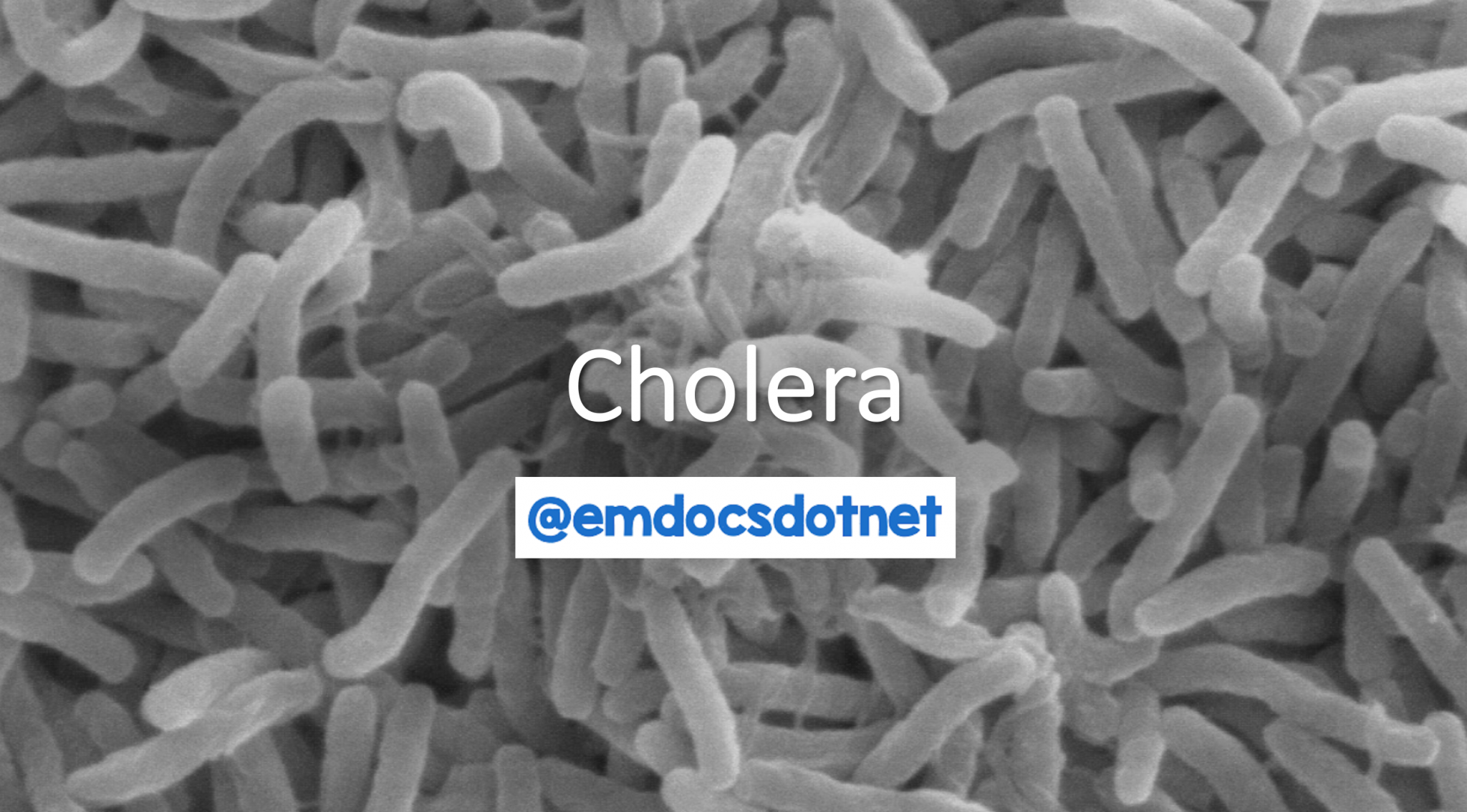 Cholera: ED presentation, evaluation, and management - emDocs