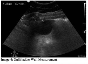 Using Point-of-Care Ultrasound to Identify the Gallbladder - emDocs