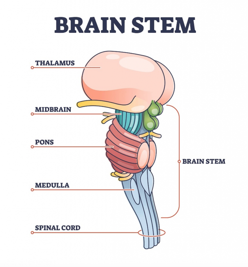 EM@3AM: Brainstem Strokes - emDocs